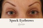 Ah! Spock Eyebrows After Botox: Lets Talk About Solution
